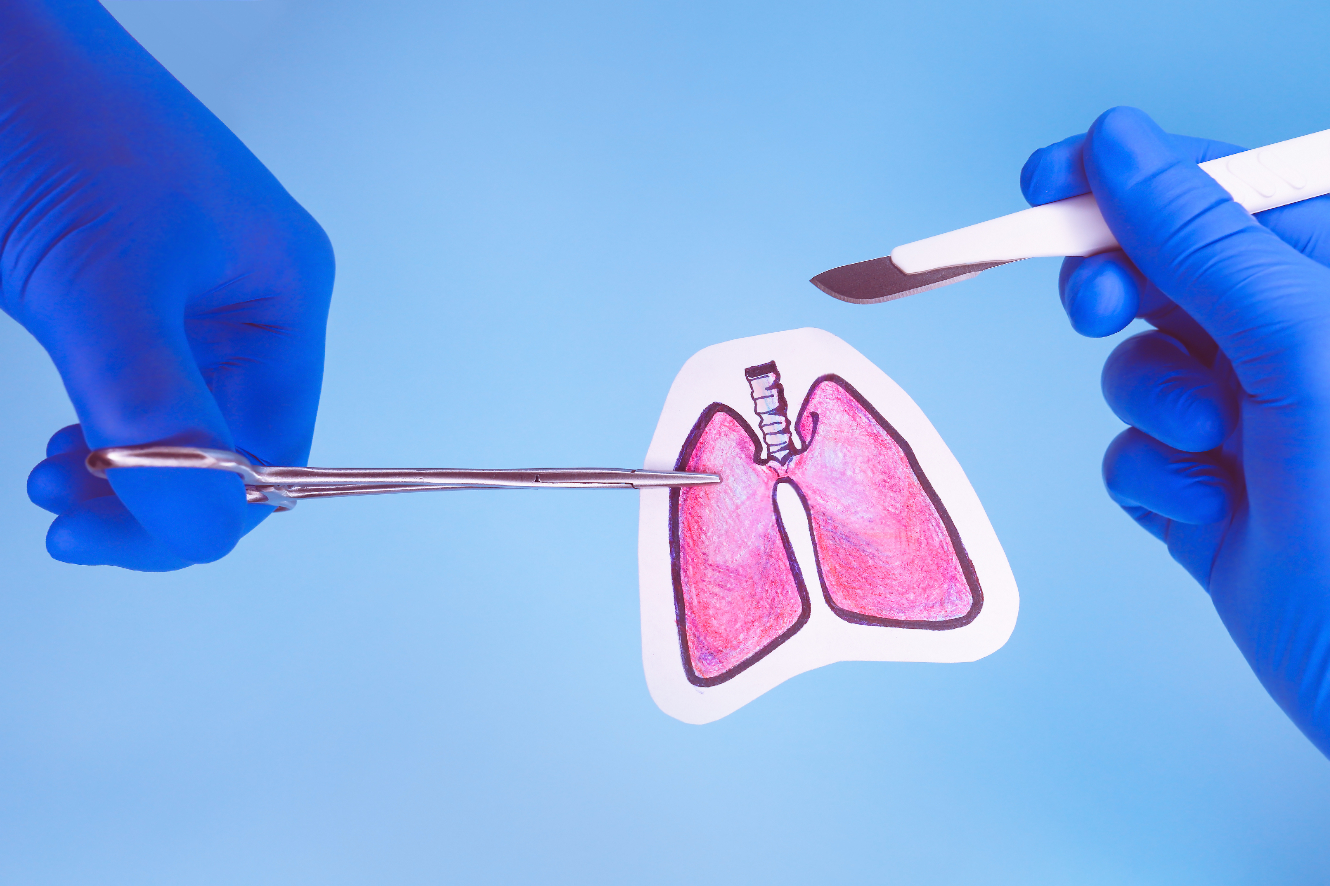 JNCCN 360 - Non–Small Cell Lung Cancer